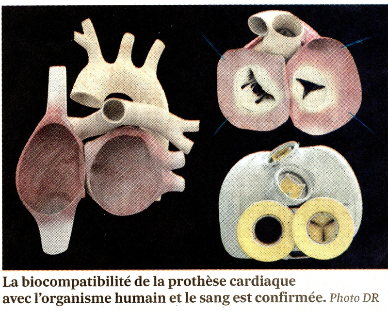 Implantation de cœur artificiel : suivez les actualités